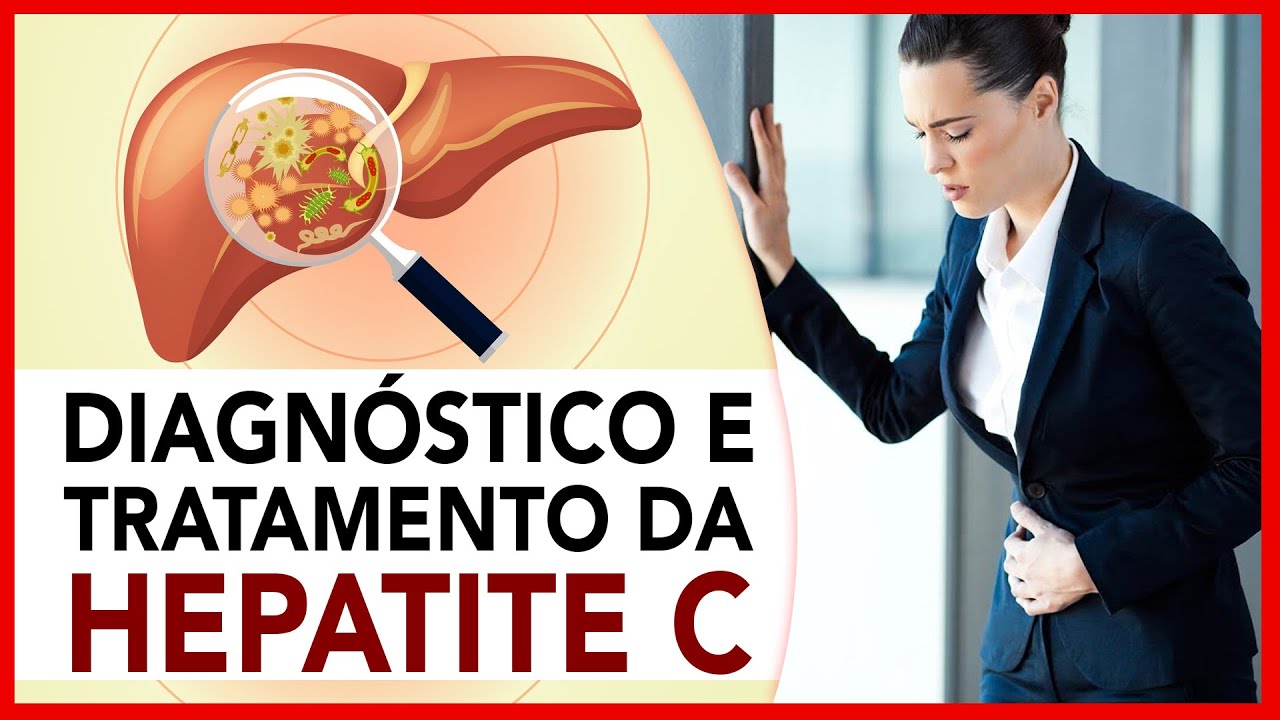 Diagnóstico e tratamento da Hepatite C - YouTube