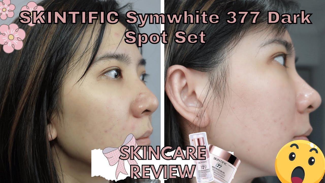 SKINTIFIC Symwhite 377 Dark Spot Serum & Moisturizer Review 2024 - YouTube
