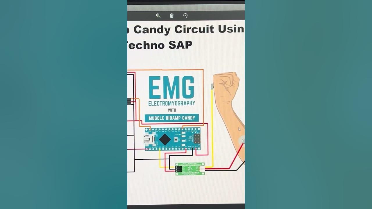 Building EMG Robotic Arm using muscle signals & @Arduino | Project by @TechnoSAP #arduino #emg ...