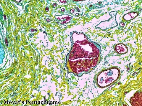 histology stains - YouTube