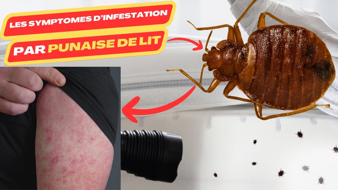 Symptômes d'infestation punaise de lit | punaise de lit noir | punaise ...