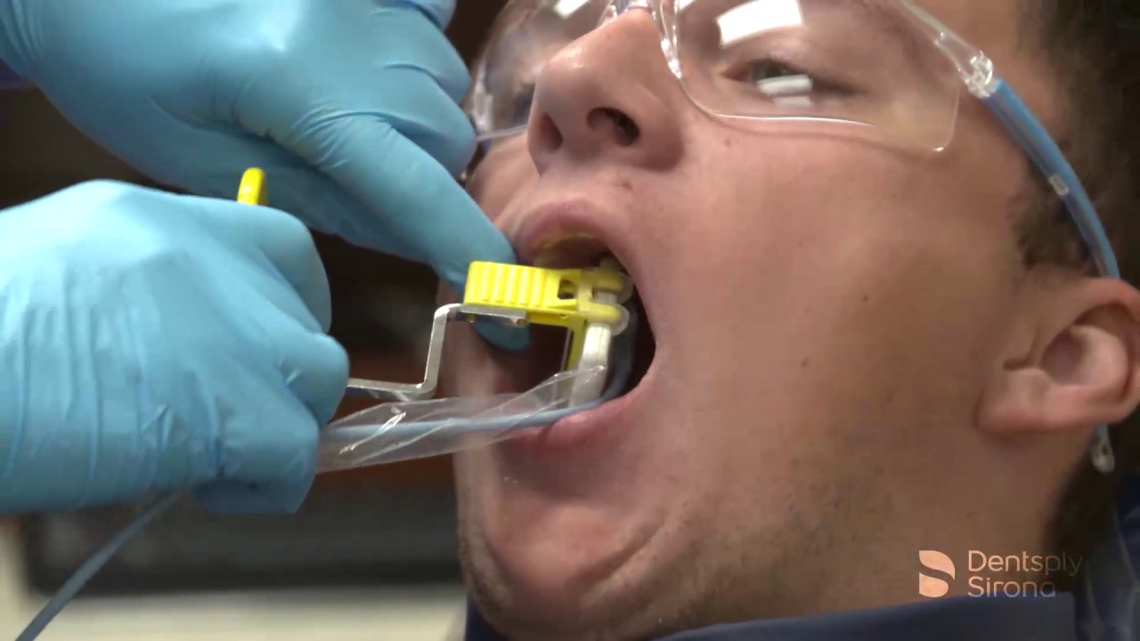 RINN XCP Short Arm Aiming Device | Dentsply Sirona - YouTube