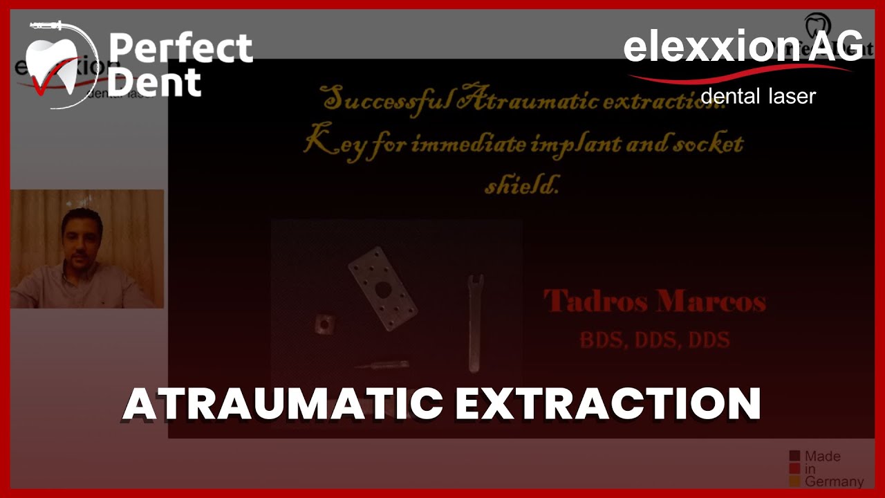 Atraumatic Extraction | elexxionAG | Dr. Tadros Marcos | Perfect Dent ...