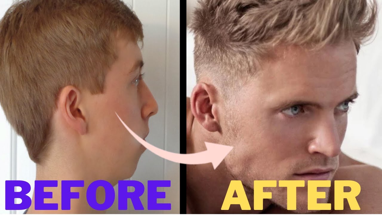 5 Simple Steps to Reshape Your Face and Boost your Confidence - YouTube