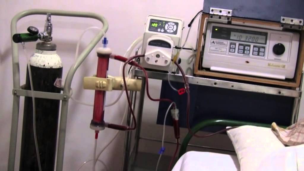 Ozone Dialysis (EBOO) - YouTube