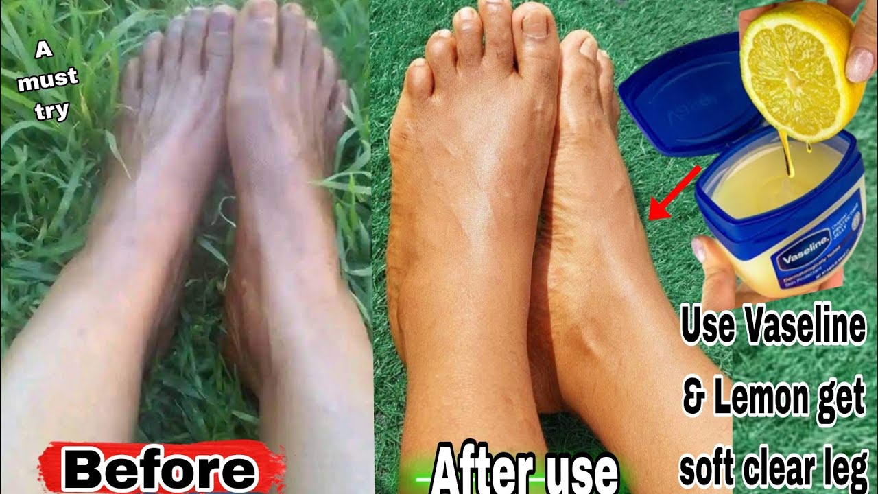 how I Cleared My Leg Wrinkles & Damage leg | To Get clear brighter ...
