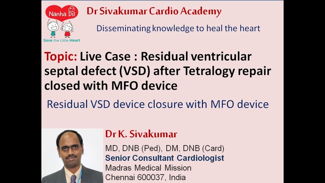10/11 Live Case : Residual VSD after Tetralogy repair closed with MFO ...