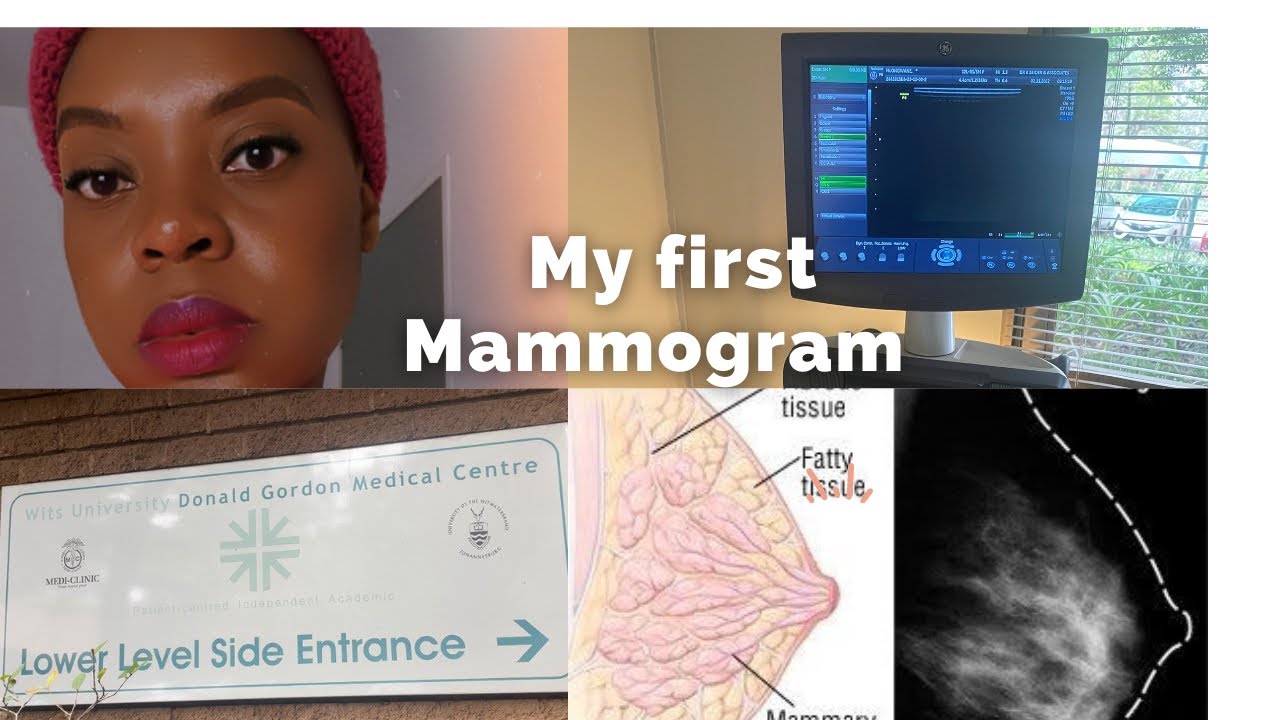 My first Mammogram experience | South African YouTuber - YouTube