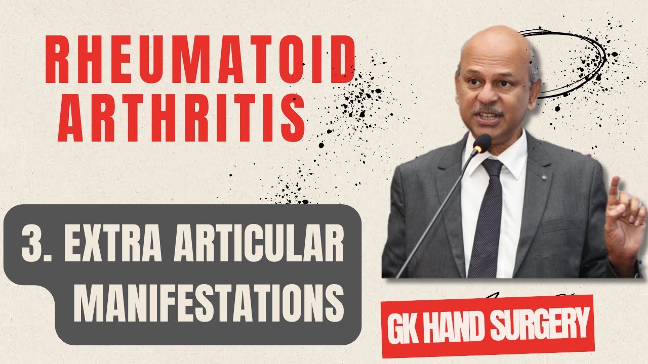 Rheumatoid Arthritis: Chapter 3 - Extra-articular Manifestations - YouTube