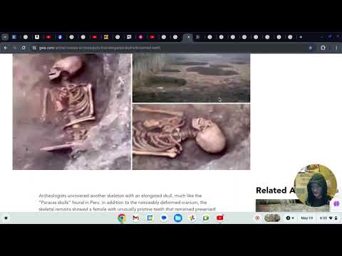 A Russian Elongated Skull Excavation and the Convoluted Theories of Artificial Cranial Deformation