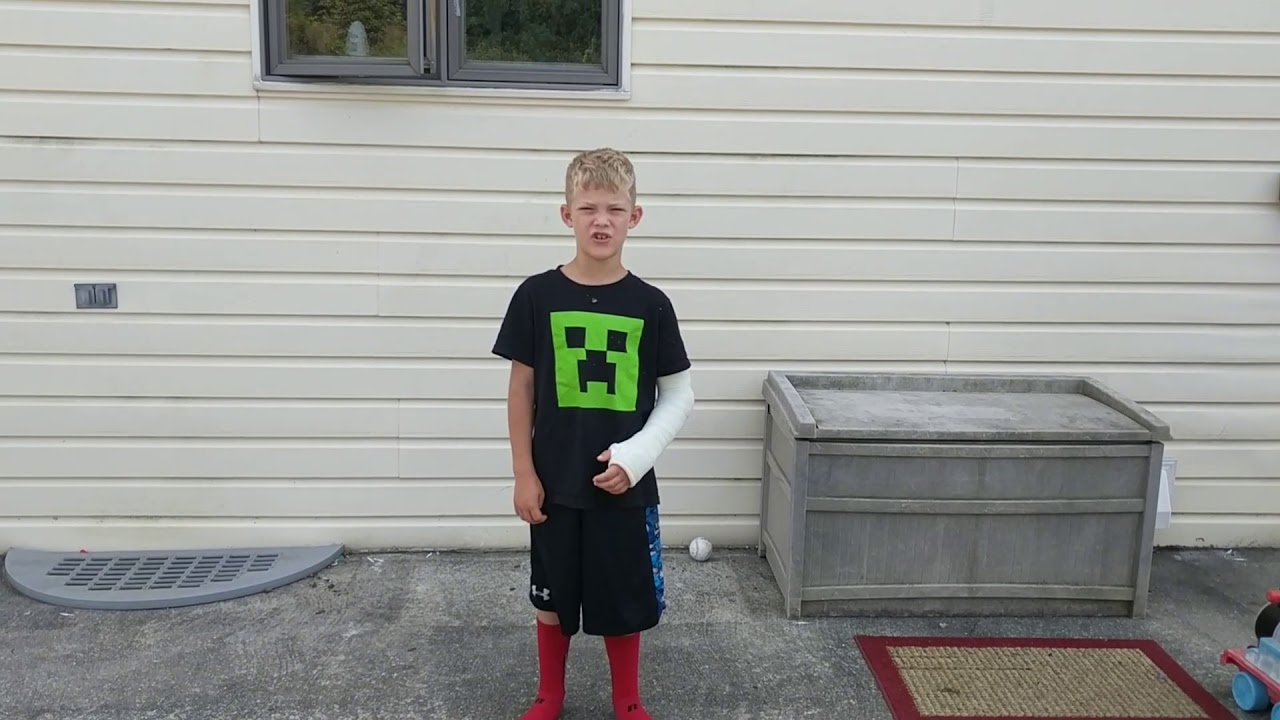 Greyson - long arm cast - YouTube