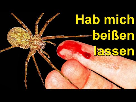 Was passiert wenn Dich die größte Spinne Deutschlands beißt? (Selbst-Test)