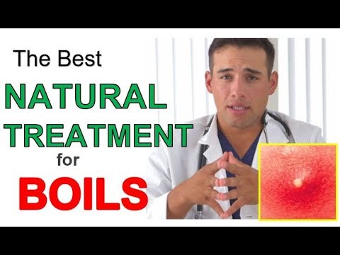 The Best NATURAL TREATMENT for BOILS | 4 Home Remedies for Treating ...
