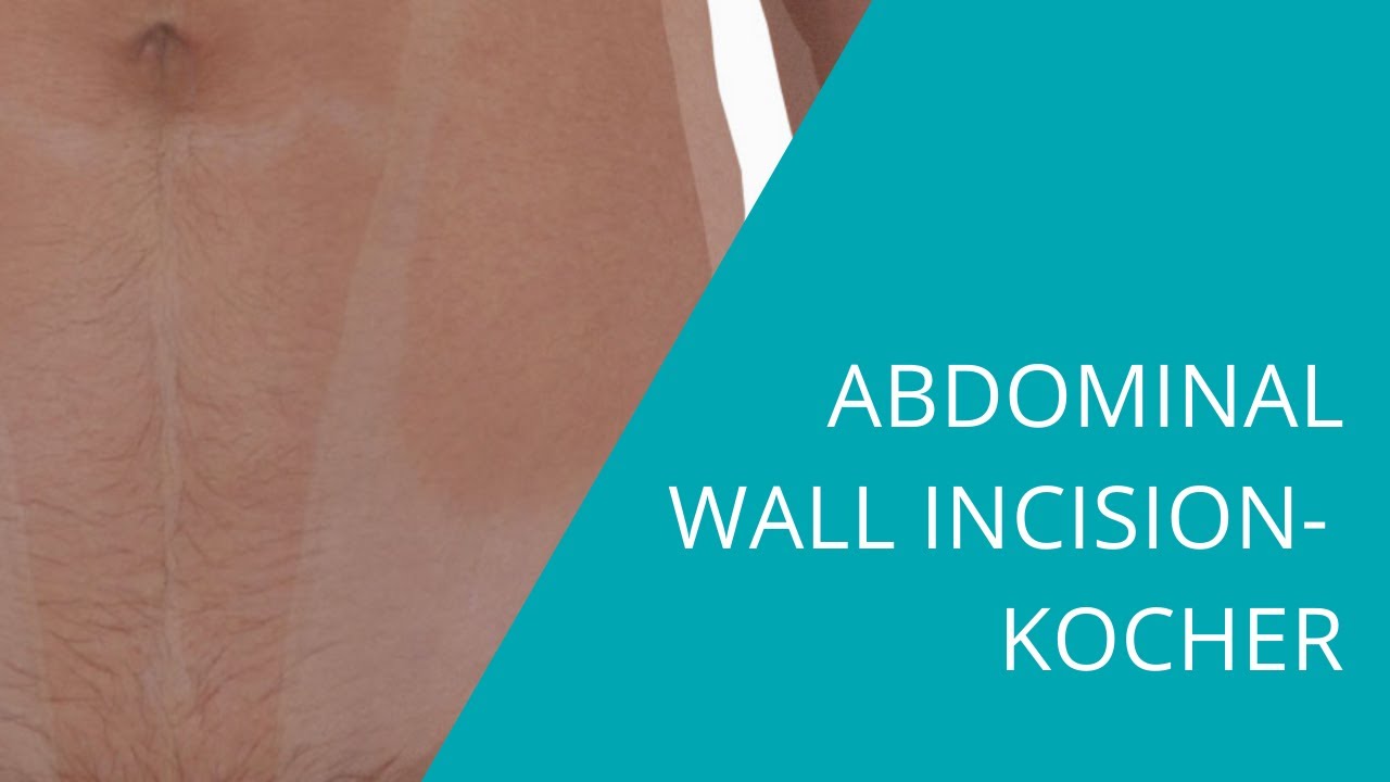 Abdominal Wall Incision - Kocher - How to approach the abdominal cavity ...