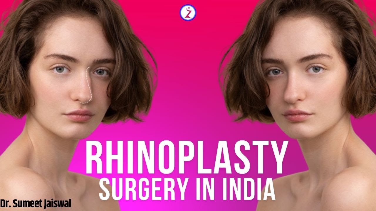 Rhinoplasty Surgery In India | Rhinoplasty Swelling Progression | Nose ...