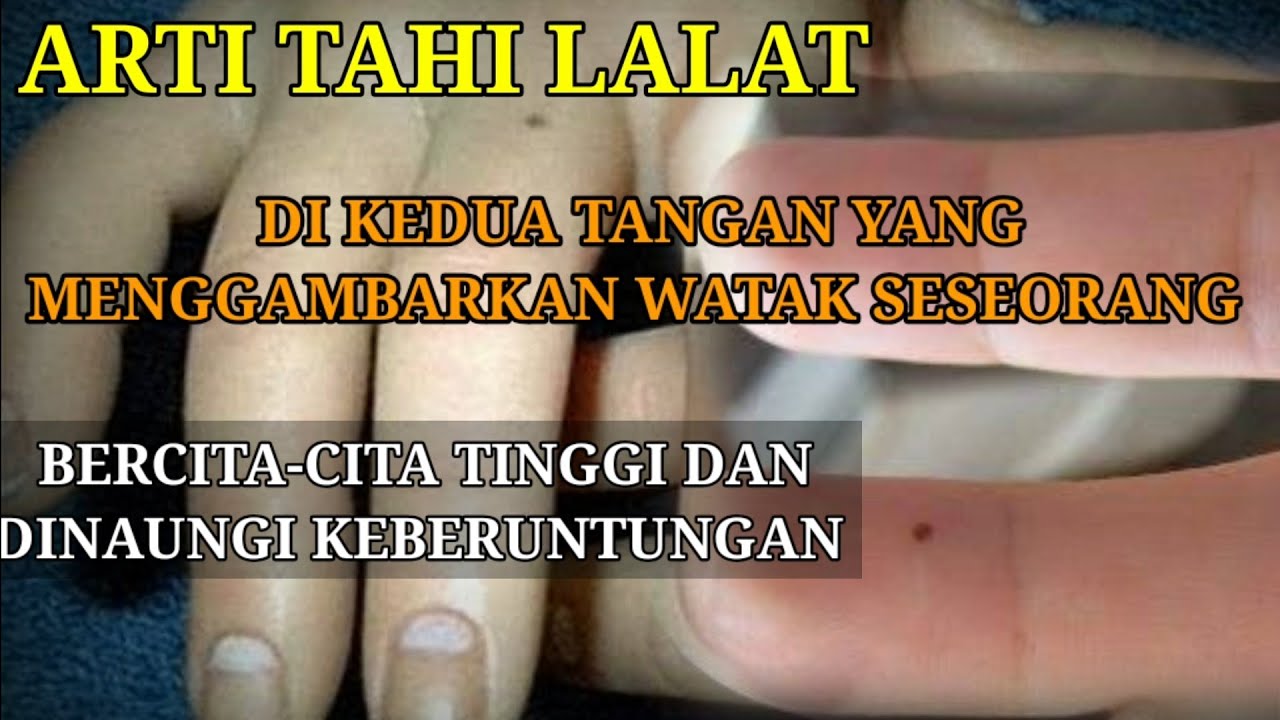 ARTI TAHI LALAT PADA TANGAN DAN SEKITARNYA, Mitos Tahi lalat, Makna arti Tahi lalat, Primbon ...