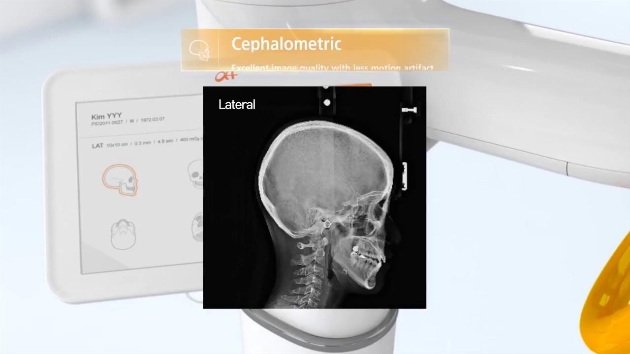 Cephalometric PA Acquisition Tutorial - YouTube