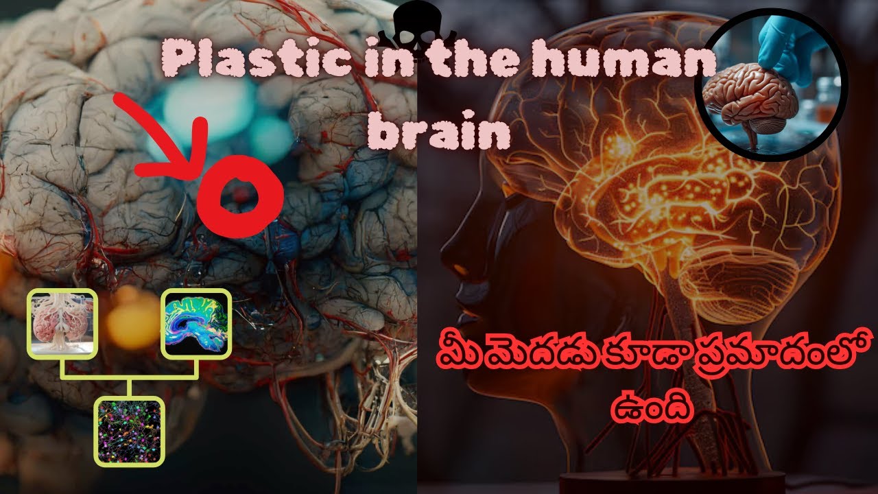 Plastic found in human brain every human is in danger #doctor# ...