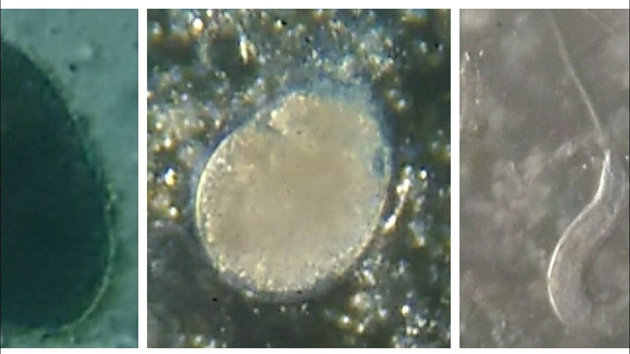 Study of gut parasites of cockroach - YouTube