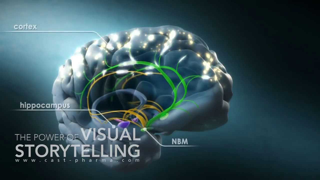 Alzheimer's Disease Interactive Mode of Action Animation - YouTube
