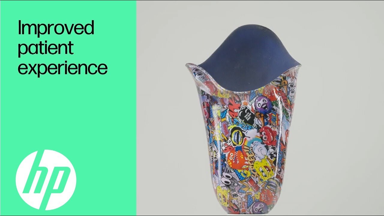 Revolutionizing Prosthetic Socket Creation with HP 3D Printing | HP ...