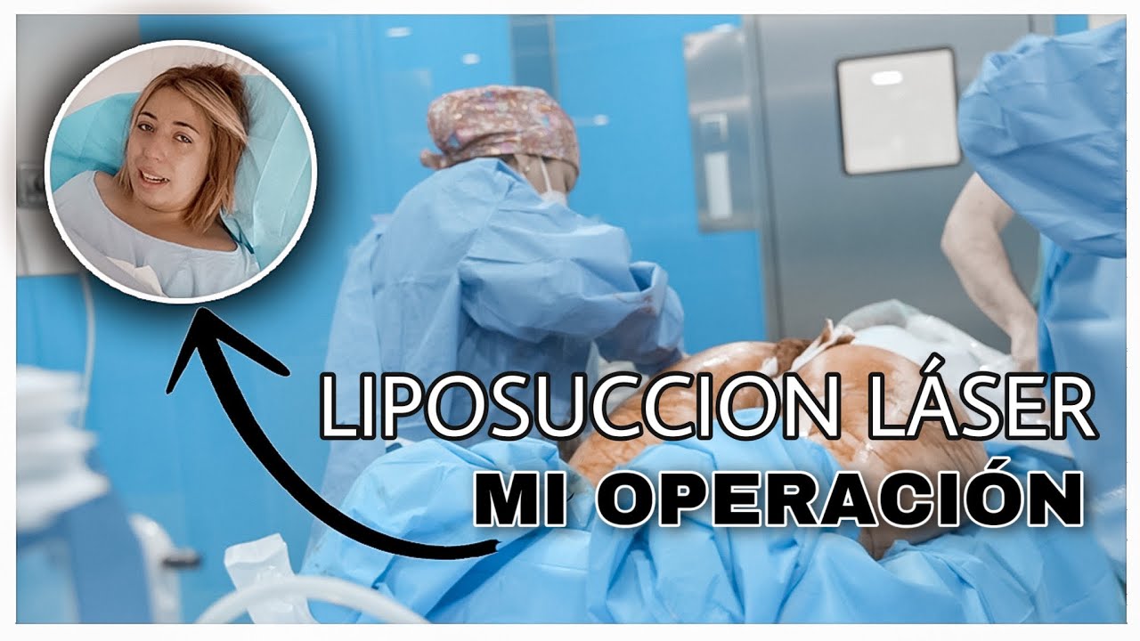 LIPOSUCCION y REMODELACIÓN 360 | MI OPERACION y EXPERIENCIA!! (Lipedema ...