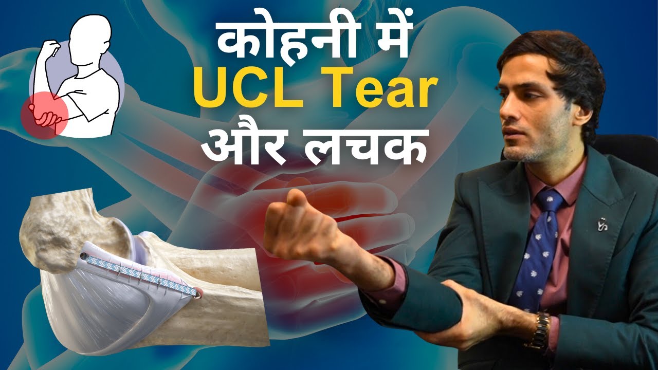 कोहनी में लिगामेंट इंजरी और लचक | Elbow Ulnar Collateral Ligament (UCL ...