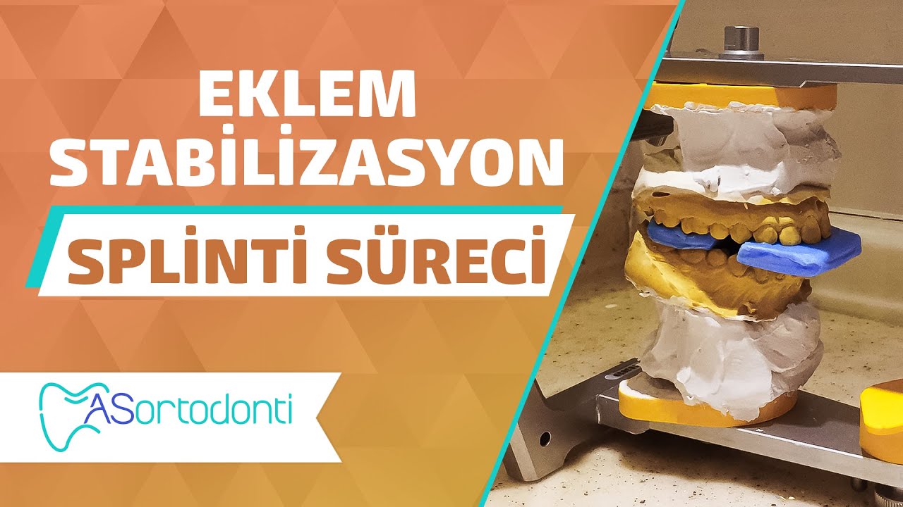Eklem Stabilizasyon Splinti Süreci | AS Ortodonti - YouTube