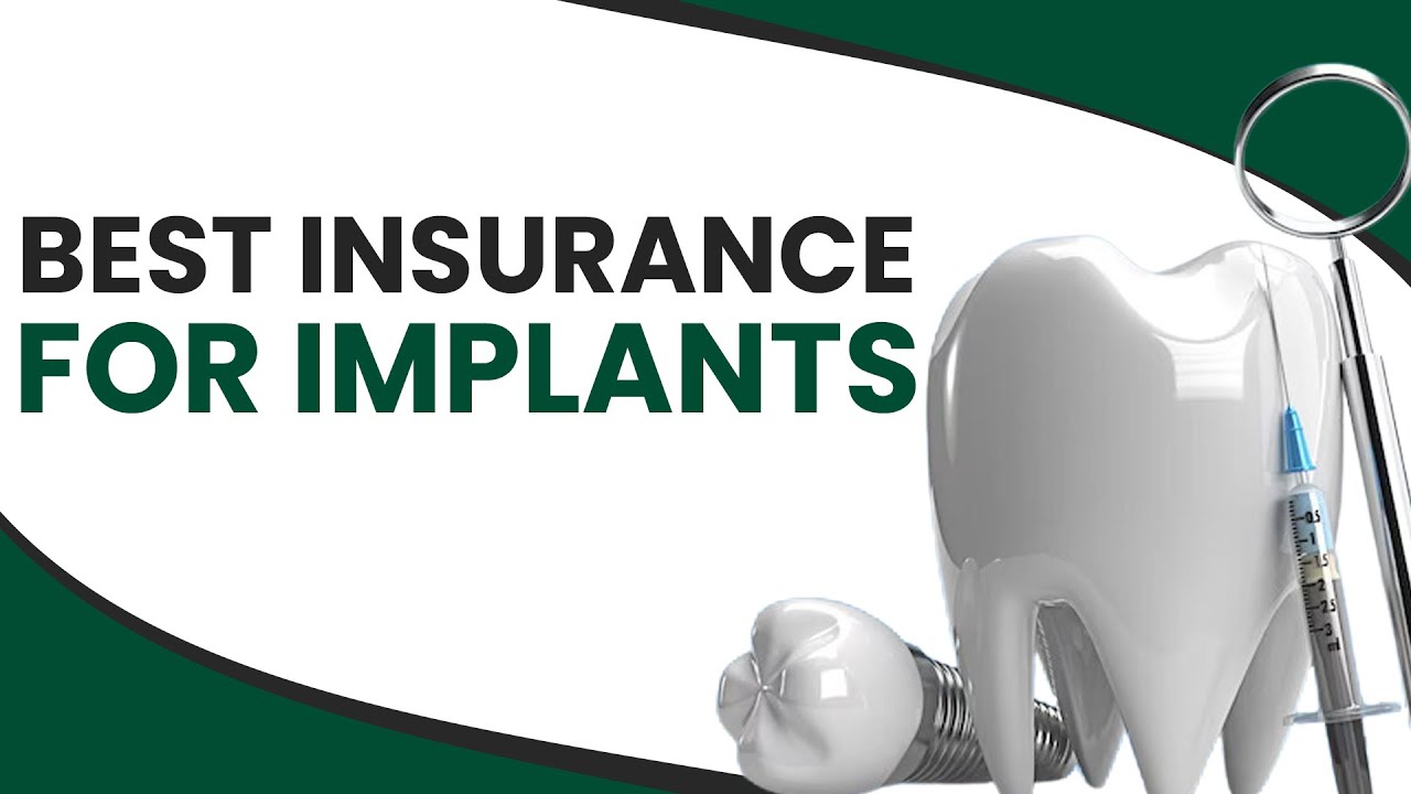 Best Insurance for Implants - YouTube