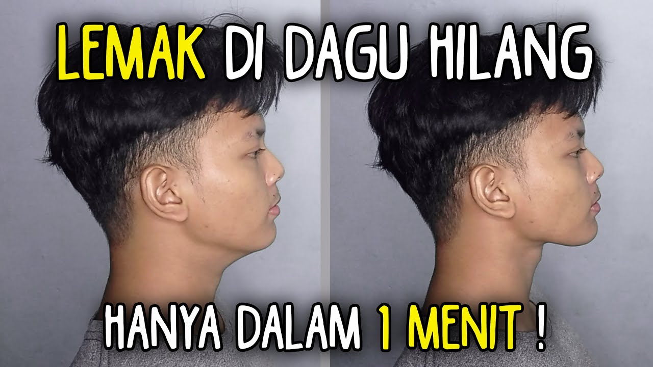 Perbaiki Postur Wajahmu Dengan "MEWING" #Shorts - YouTube