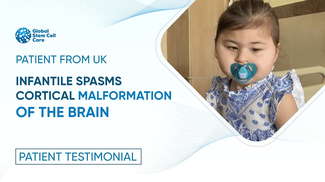 Stem Cell Treatment For Brain Injury | Infantile Spasms Cortical ...