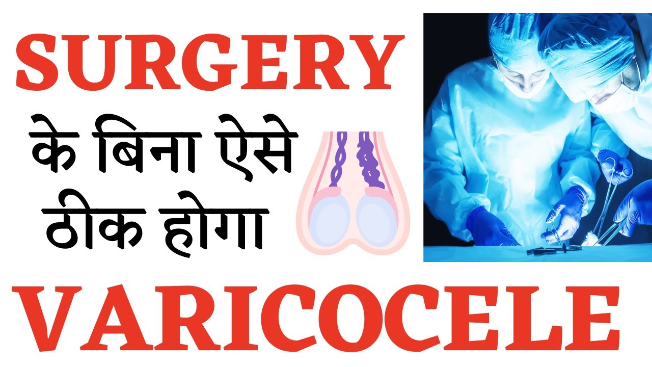 Varicocele Natural Treatment Homeopathy | Varicocele Treatment Without ...