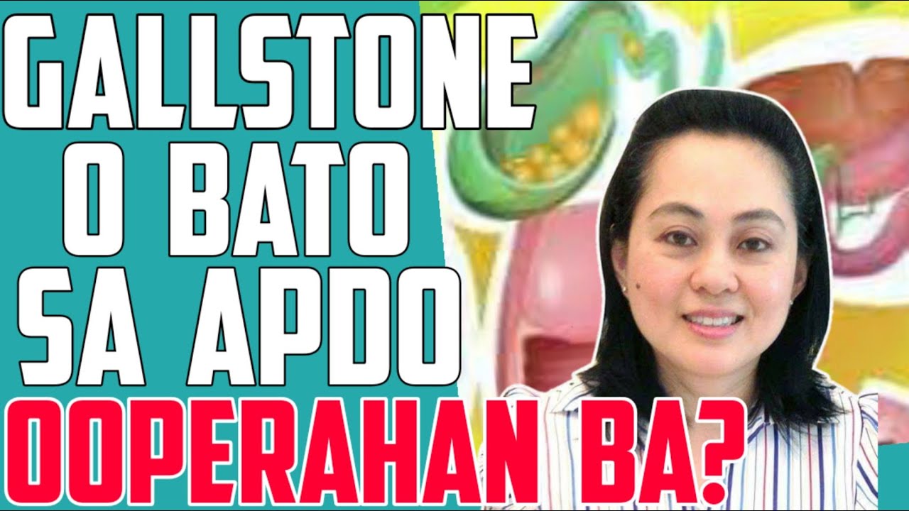 Gallstone o Bato sa Apdo: Ooperahan ba? - by Doc Liza Ramoso-Ong - YouTube