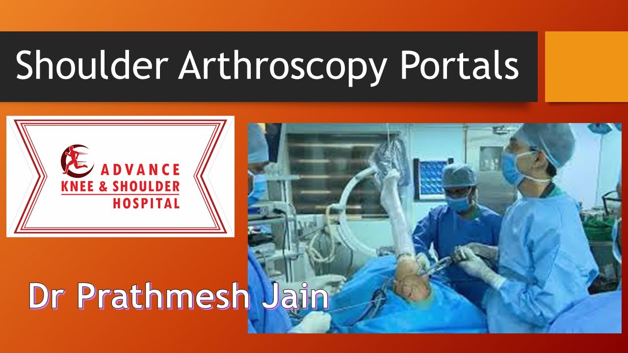 Shoulder arthroscopy Position and Portals for Training of Orthopedic ...