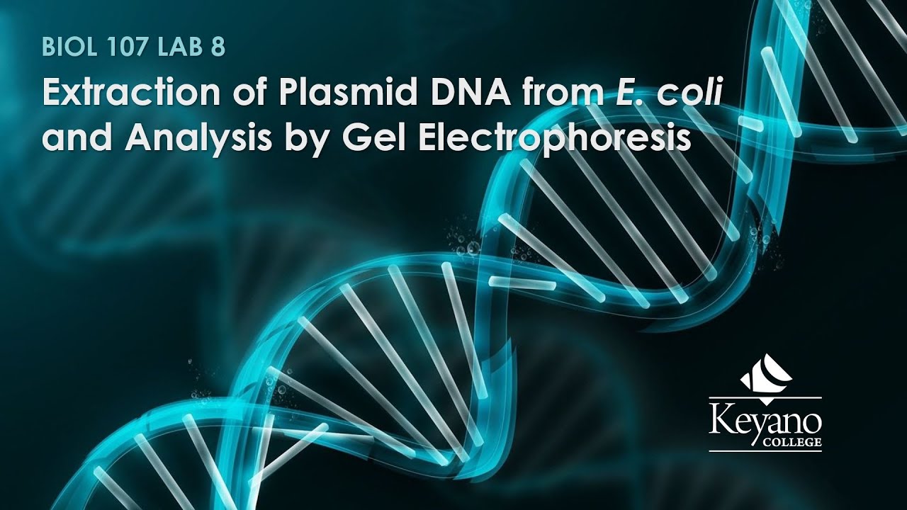 BIOL 107 Lab 8 - Extraction of Plasmid DNA & Analysis by Gel ...