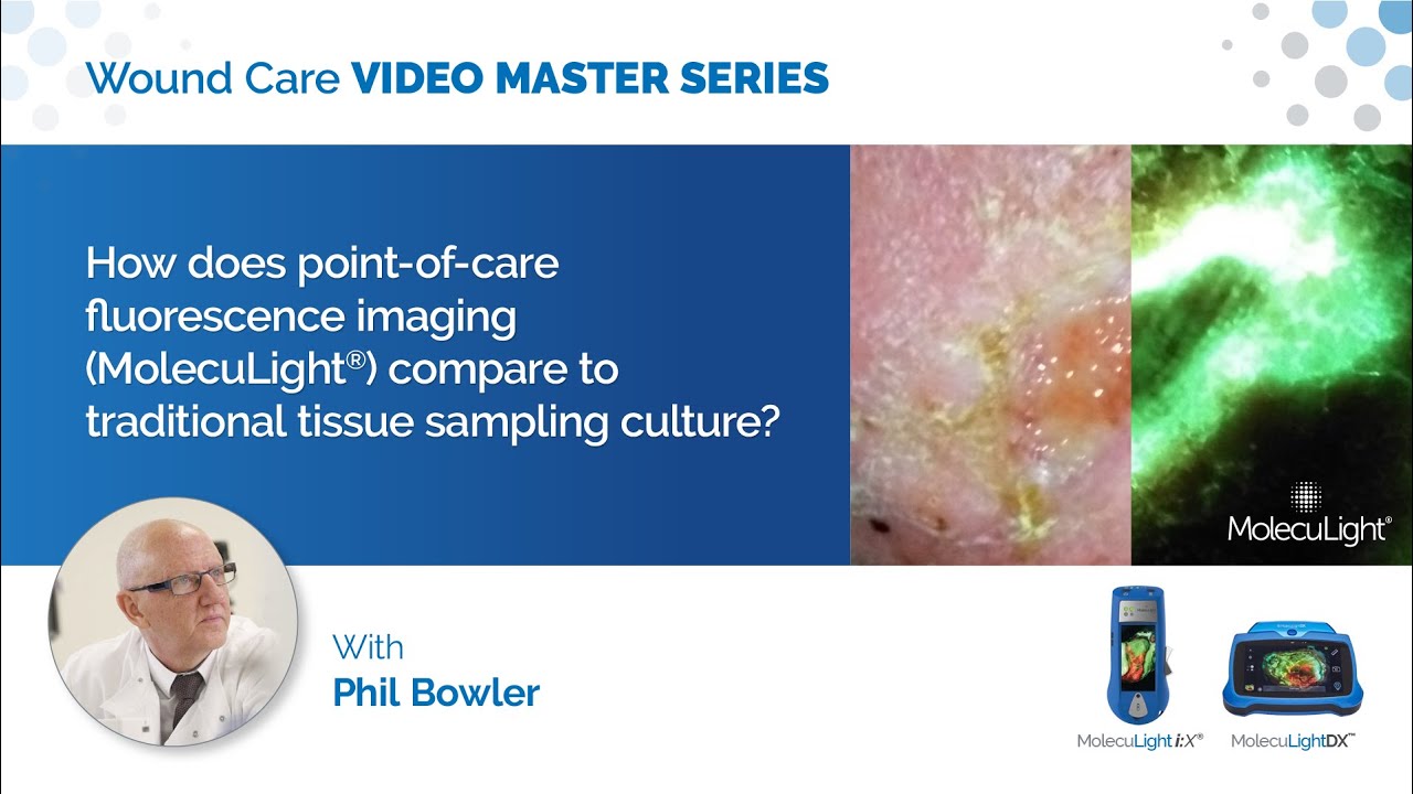 How does point-of-care fluorescence imaging (MolecuLight) compare with ...