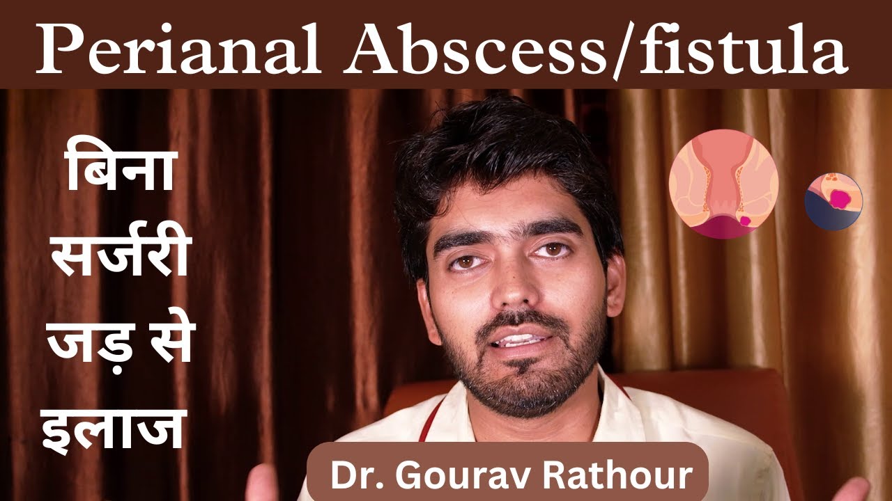 WHAT IS PERIANAL ABSCESS CAUSES SYMPTOMS TREATMENT WITHOUT SURGERY # ...