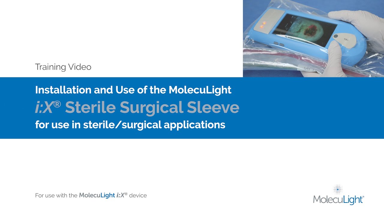 MolecuLight i:X Sterile Surgical Sleeve for Imaging Wounds in a Sterile ...