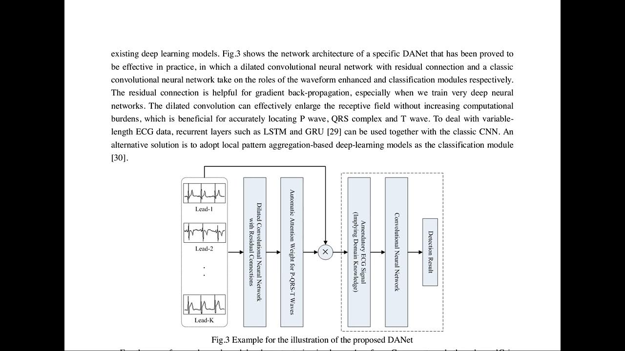 ECG Arrhythmia Detection Using Disease-specific Attention-based Deep Learning Model - Ar - YouTube