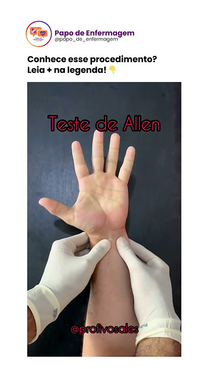 Descubra Como Fazer o Teste de Allen Corretamente!💫 Descubra a emoção ... Descubra Como Fazer o Teste de Allen Corretamente!💫 Descubra a emoção ...