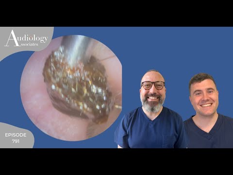 EAR WAX REMOVAL COMPILATION: DEEP PLUGS, SKIN REMOVALS & NARROW EAR ...