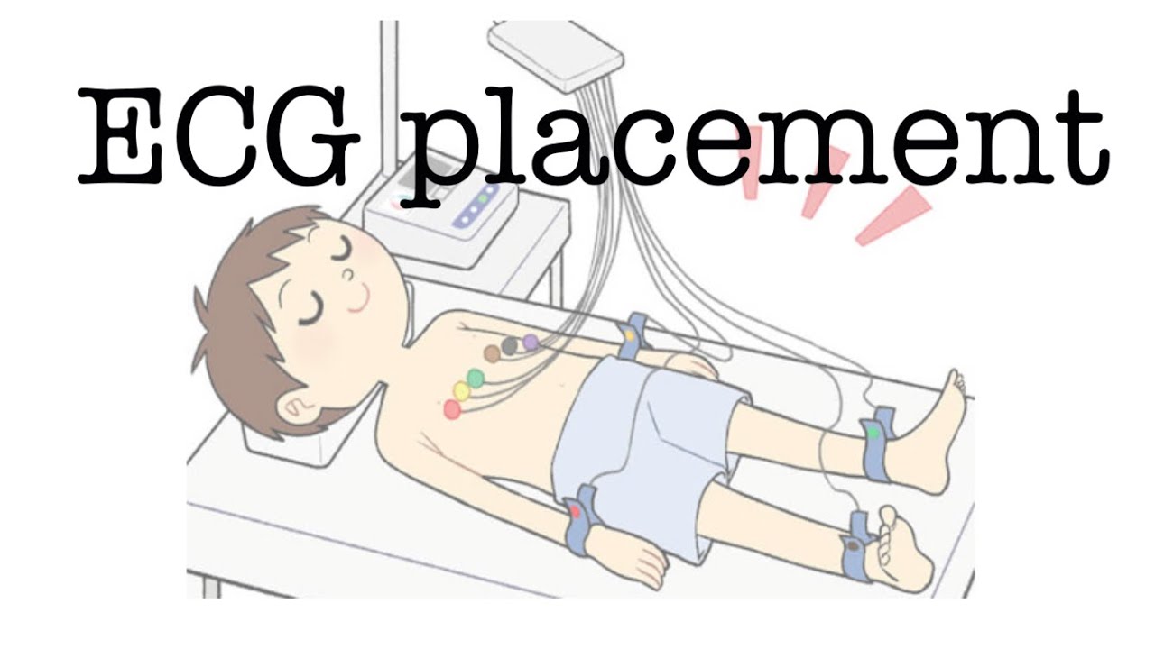 ECG Preparation and Placement! - YouTube