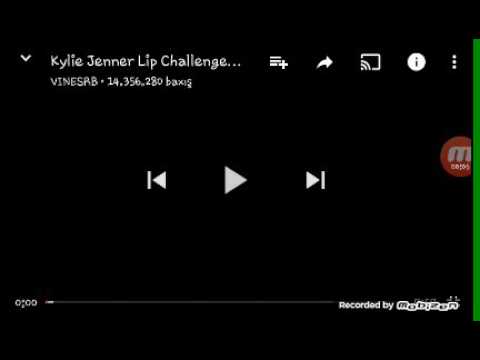 Dudak Buyutme Challenge#1 Dudak Beni Benden Aldı