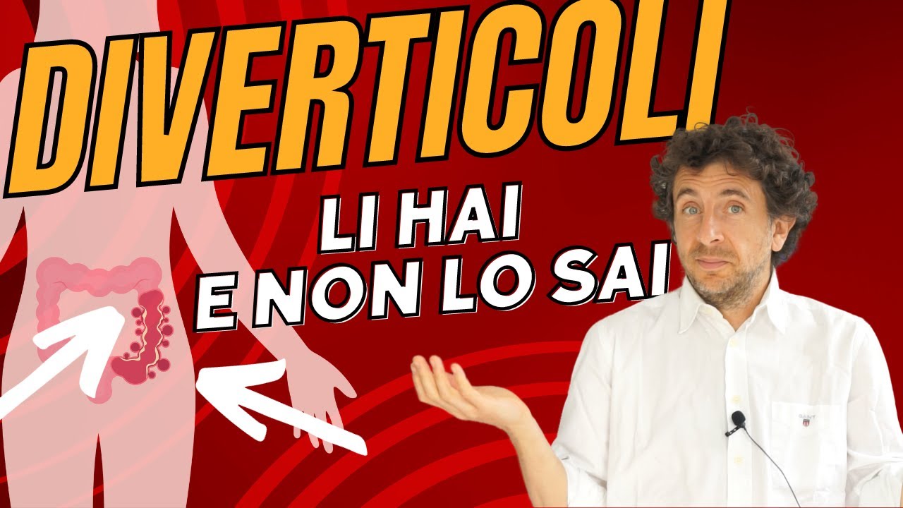 DIVERTICOLI: cosa sono, sintomi, dieta ideale e rischi di diverticolite ...