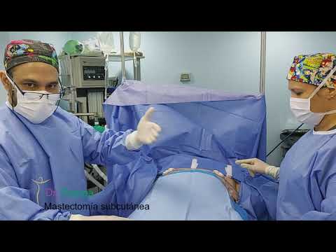 Mastectomía Subcutánea - YouTube