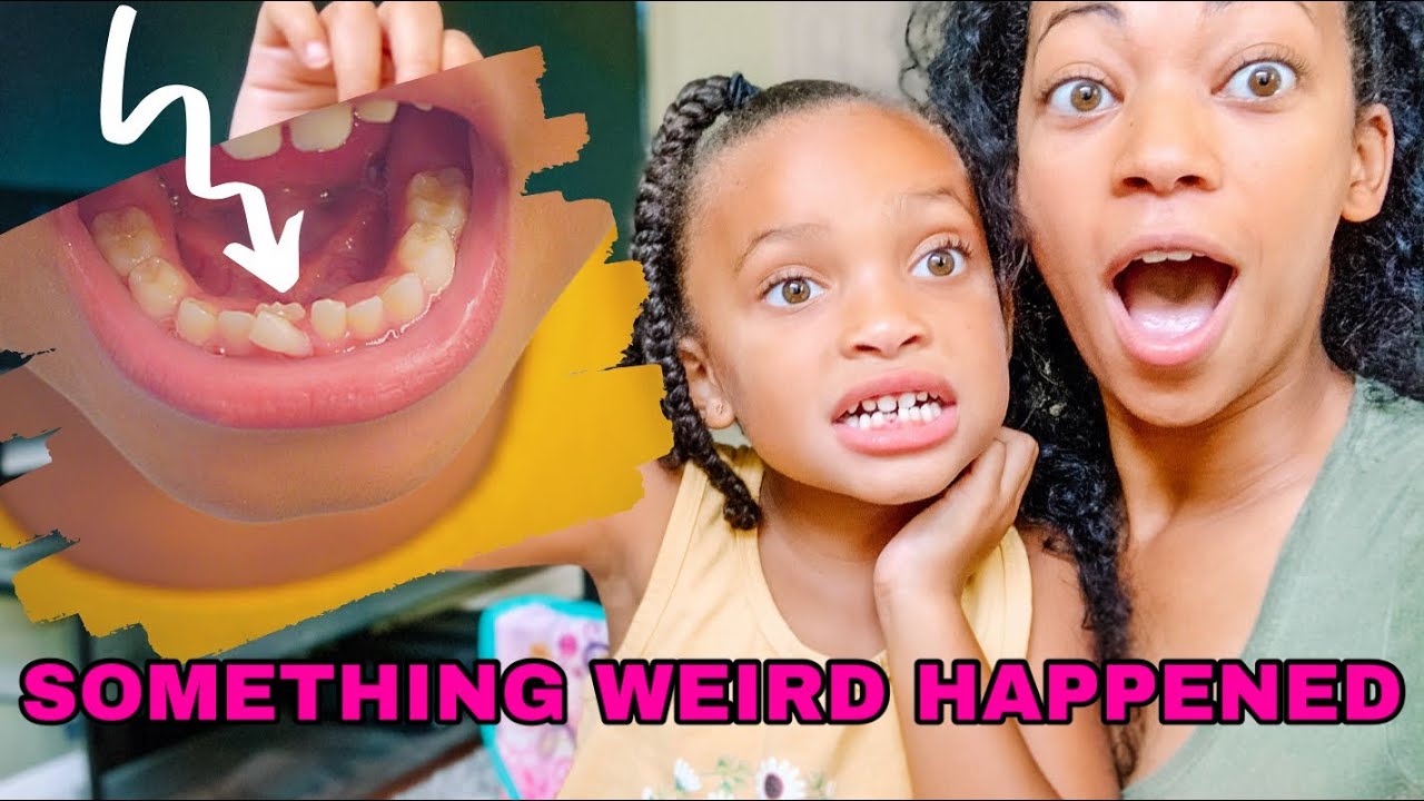 Daughter has Adult Tooth before Baby Teeth Falls Out | Logan Looses her ...