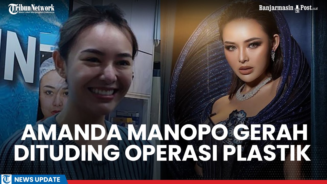 Karier Amanda Manopo Ikut Terdampak, Gara-gara Tudingan Operasi Plastik ...