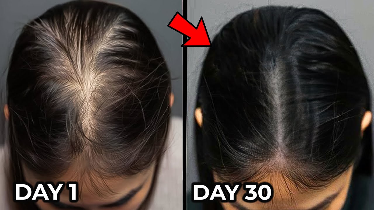 15 Amazing hair Growth/Grey hair hacks & tips!! #beauty ⁠ @ArtkalaAngan ...