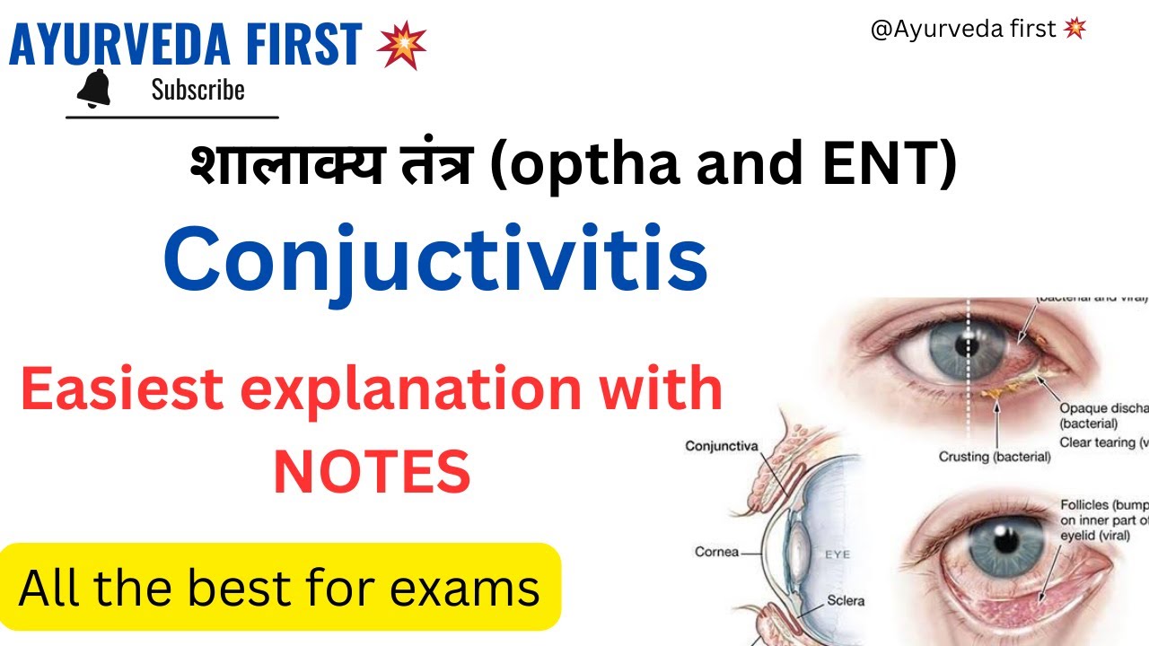 Conjunctivitis ||Notes &explaination|| optha||Shalakya tantra @Ayurveda ...