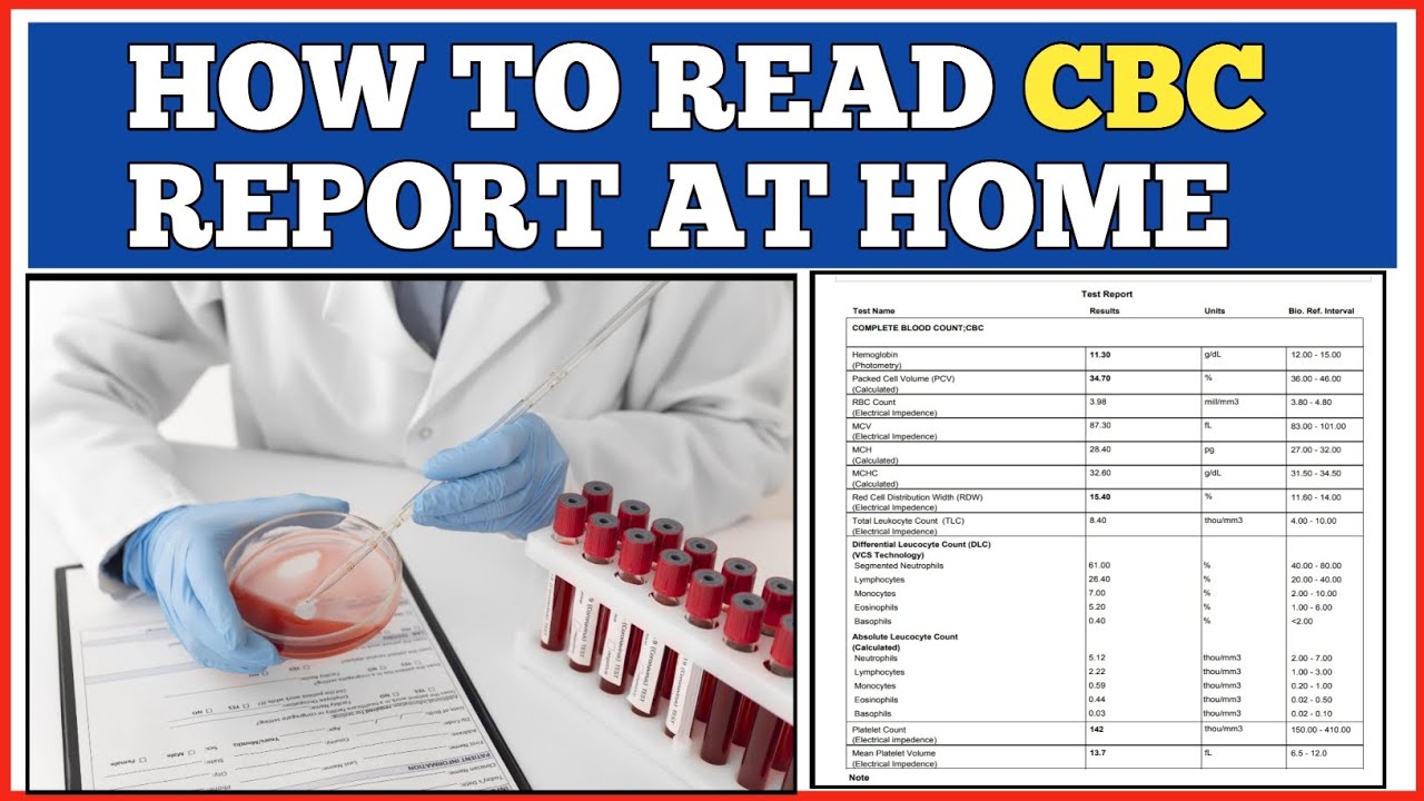 cbc report kaise padhe | blood report kaise padhe - YouTube